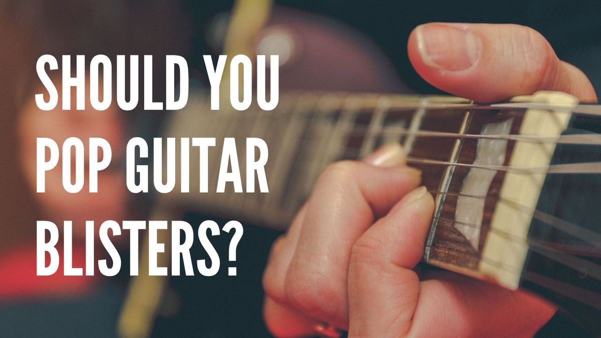 Should You Pop Guitar Blisters? Guide for Musicians | Style Of Pop